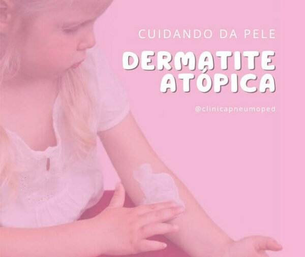 Dermatite Atópica: Cuidando da Pele dos Pequenos - Clínica Pneumoped